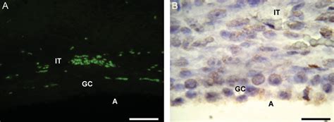 Tunel Positive Cell Detection In The Pubertal Human Ovary Tunel Signal