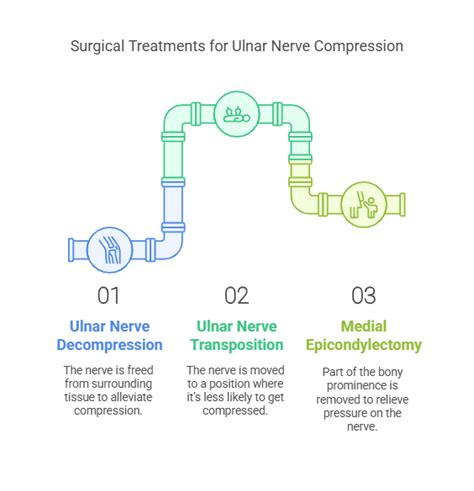 Symptoms That Signal You Might Need Ulnar Nerve Surgery