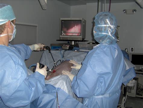 1 Laparoscopic Procedure 15 Download Scientific Diagram