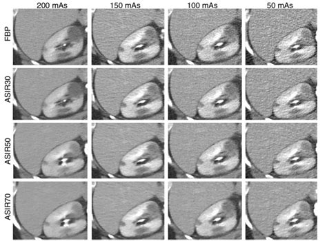 13 Comparison Of The Specificity Of The Image With Standard Filtered