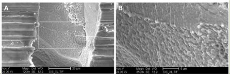 Sem Micrographs Of The Surface Topography Of Ductility Dip Crack In The Download Scientific