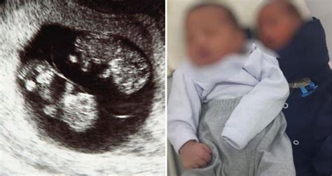 Brazilian Woman Gives Birth To Twins With Different Fathers