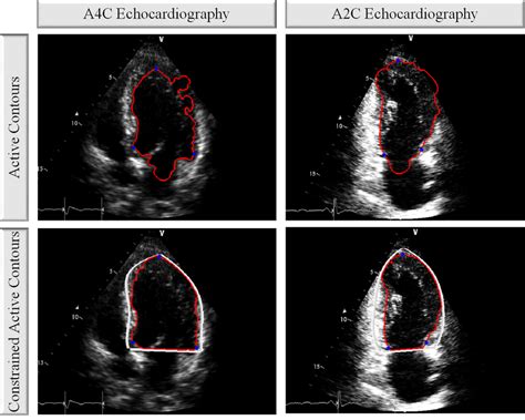 The Comparison Of The Original And Constrained Active Contours In Both