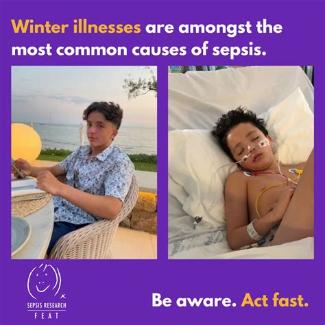 Sepsis Research On Linkedin Sepsis Flu Pneumonia Strepa Infection