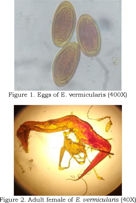 Figure 1 From Molecular Identification Of Enterobius Vermicularis Worms