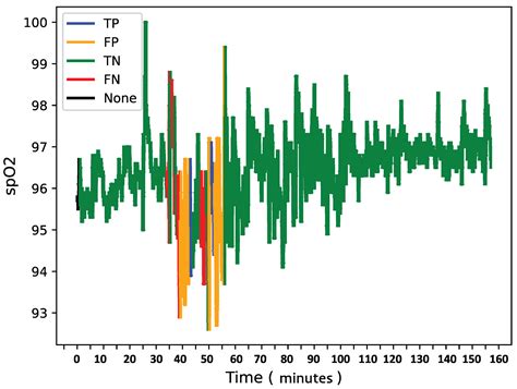 Advanced Data Framework For Sleep Medicine Applications Machine Learning Based Detection Of