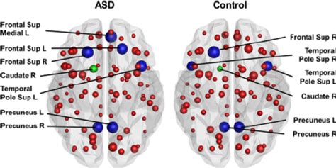 local results in the binary networks in the binary network subjects
