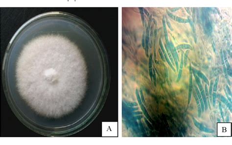 Figure 5 From Effects Of Biochar And Poultry Manure On The Composition Of Phosphorus