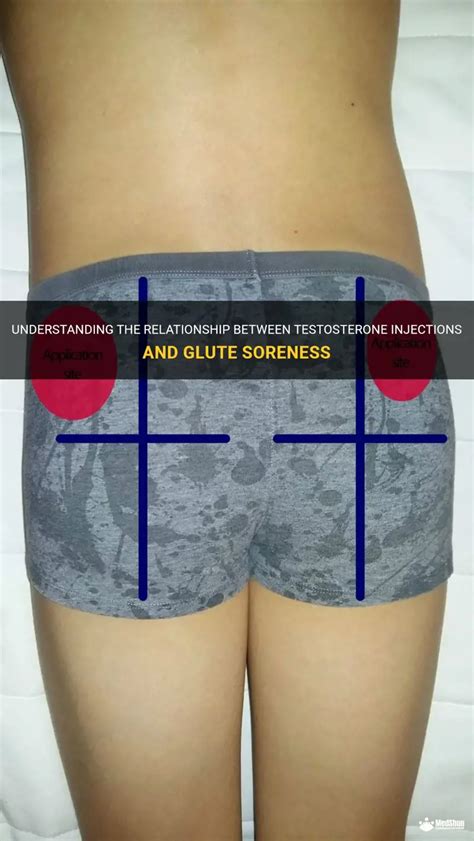 Understanding The Relationship Between Testosterone Injections And Glute Soreness Medshun