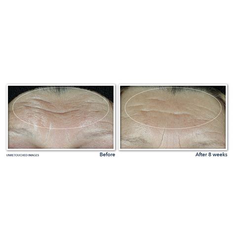 Retinol Correxion® Line Smoothing Max Hydration Roc® Australia Roc Australia