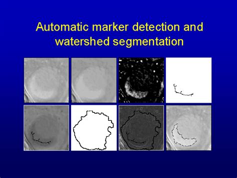 Automatic Marker Detection And Watershed Segmentation
