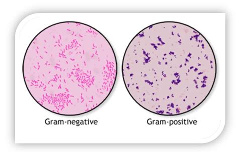 gram staining principle procedure and result