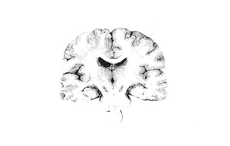 Coronal Brain Diagram Quizlet Coronal Brain Diagram Quizlet