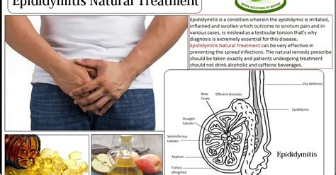 Epididymitis Natural Treatment Stop Further Complications