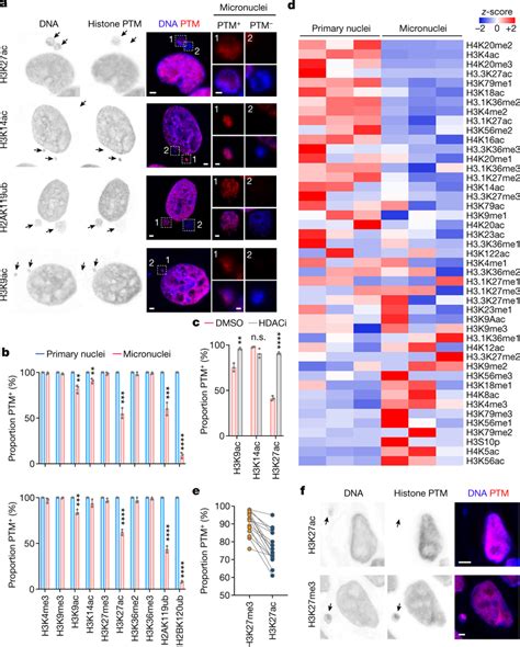 Distinct Histone Ptms In Micronuclei A Representative Download Scientific Diagram