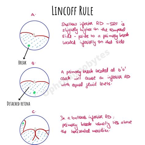 Lincoff Rules — Ophthalmobytes