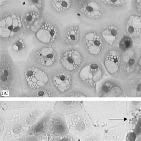 Human Epithelial Cells Light Microscope