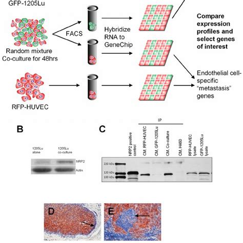 Global Gene Expression Profiling Of Melanoma Endothelial Cell