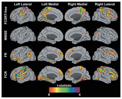 Statistical Parametric Maps At P