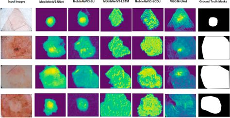 Class Activation Mapping Cam Of The Last Convolutional Layers
