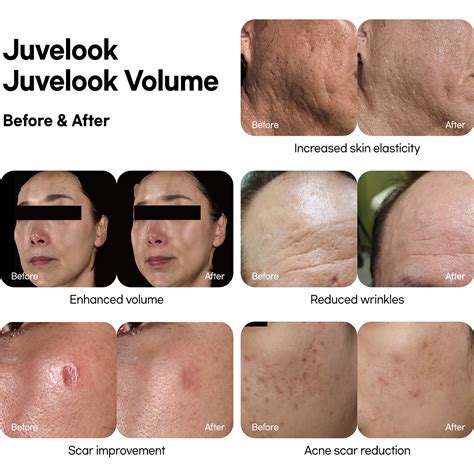 Juvelookjuvelook Volume