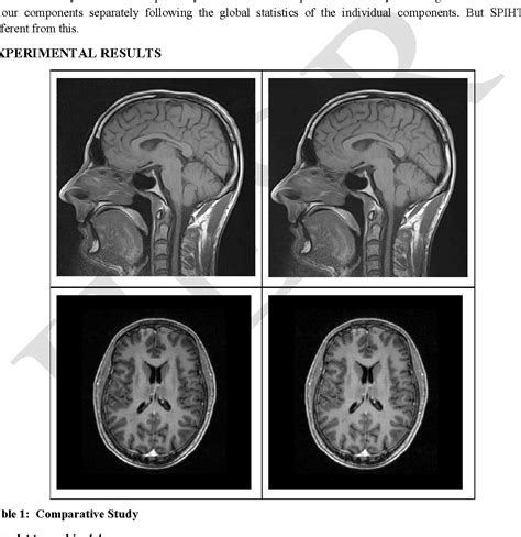 Table 1 From Region Of Interest Medical Image Compression Using Set