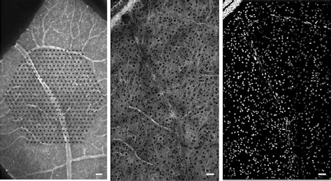 figure 1 from anatomical identification of extracellularly recorded