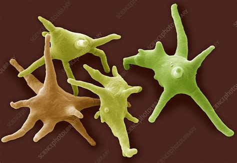 Amoeba Sem Stock Image Z110 0249 Science Photo Library