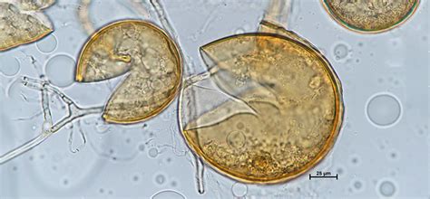 How Rhizophagus Intraradices Is Manufactured For Agriculture The Power