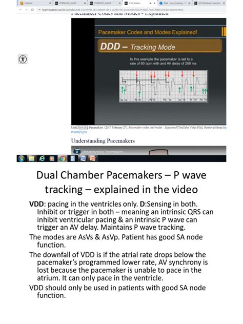 Pacemaker Ddd Pdf