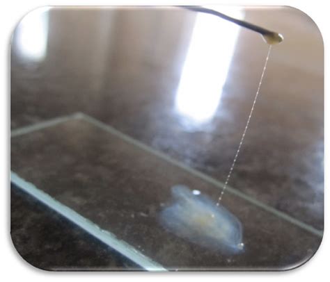 Potassium Hydroxide String Test Principle Procedure Uses And Result