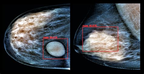 Real Time Face Liveness Detection With Python Keras And Opencv By Jordan Van Eetveldt Tds
