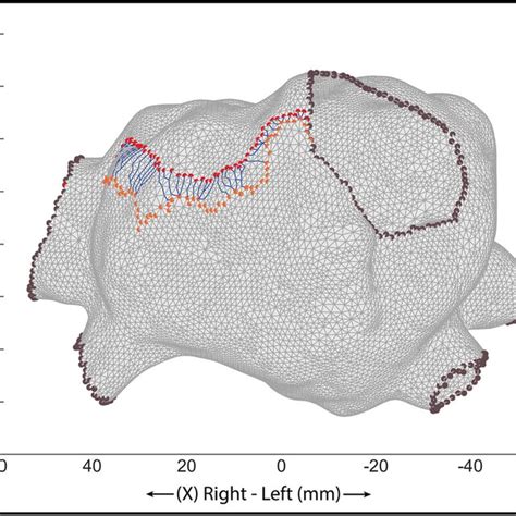 A Atrial Isochronal 3d Activation Map Of Perimitral Atrial Flutter Download Scientific Diagram