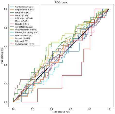 Augmentasi Data Di Gambar Medis
