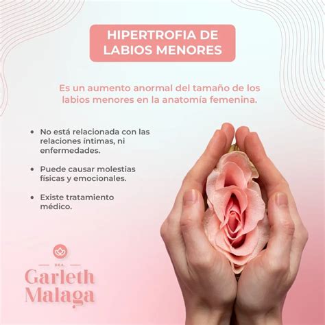Dra La Hipertrofia De Labios Menores Afecta A 6 De Cada 10 Mujeres