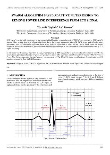 Performance Analysis Of Adaptive Noise Canceller For An Ecg Signal Ppt