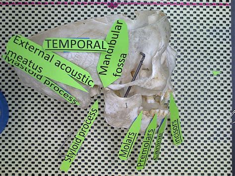 Unit Axial Skeleton Stagg High Babe Anatomy Physiology
