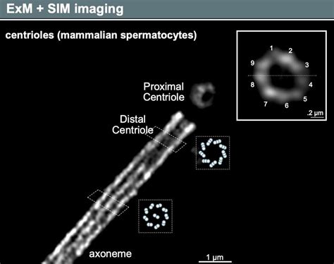 Technology Highlights Expansion Microscopy Focalplane