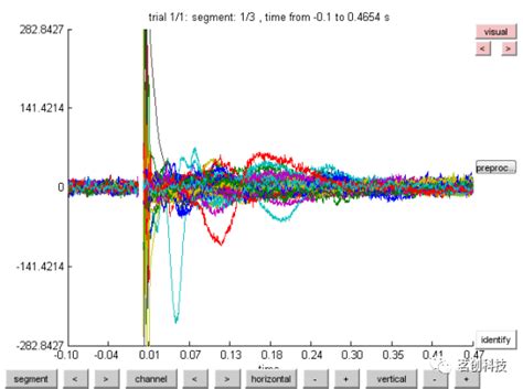 超详细tms Eeg数据处理教程（上） Csdn博客