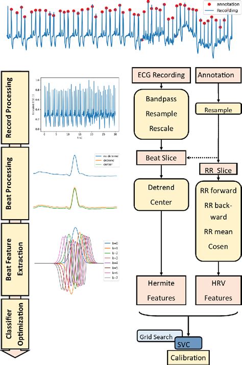 Figure 1 From Automated Detection Of Ventricular Heartbeats From Electrocardiogram Ecg