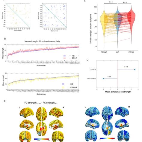Empirical Functional Connectivity Alterations A Differences In Group
