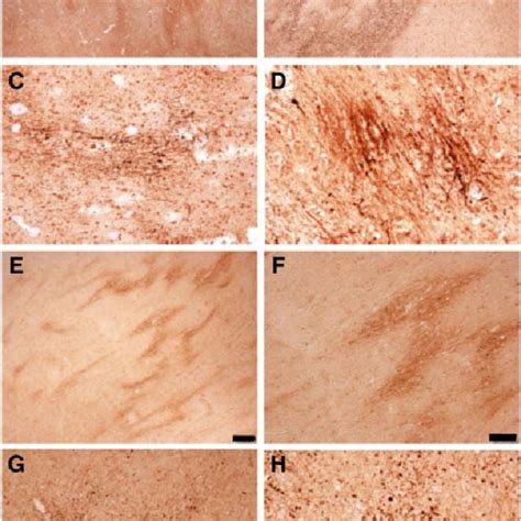 Photomicrographs Of Immunohistochemical Iba1 Staining Of Microglia In