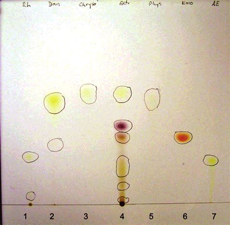 Tlc Of Anthraquinone Extract And Standards From Left To Right Rhein Download Scientific