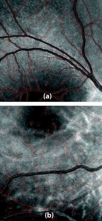 Algorithms For Automated Oximetry Along The Retinal Vascular Tree From Dual Wavelength Fundus Images