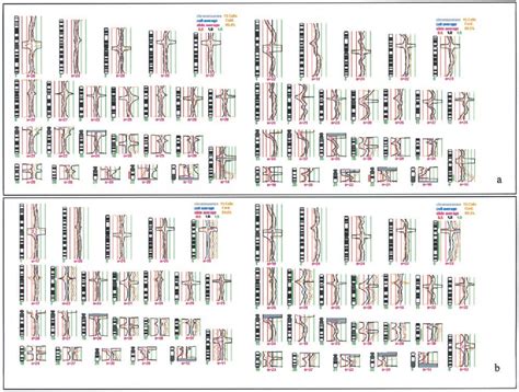 Figure 1 From Genomic Imbalances In Pediatric Intracranial Ependymomas Define Clinically