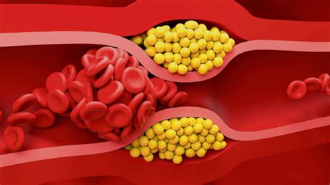 HDL Kolesterol Nedir