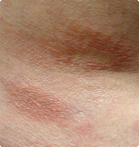 Ctcl Staging Tool Probe In Ctcl