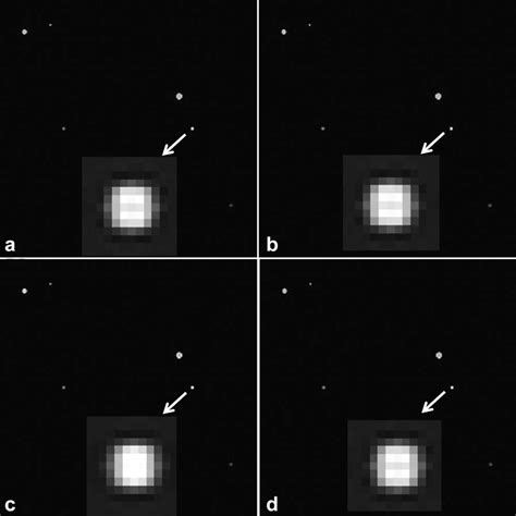 Shows The Signal Intensity Distribution In Reconstructed Images With Download Scientific