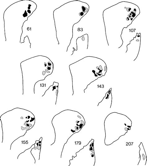 Figure 1 From Mosaic Architecture Of The Somatic Sensory Recipient