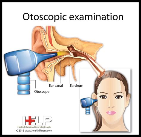 What Does Eardrums Look Like At Jessica Zelman Blog